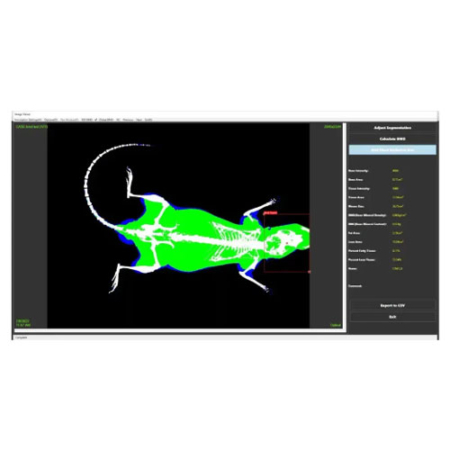 DIGIMUS® Bone Mineral Density (BMD) Analysis Software - 樂斯科生物科技股份有限公司